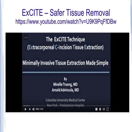 Ex cite safer-tissue-extraction-explained | PDF
