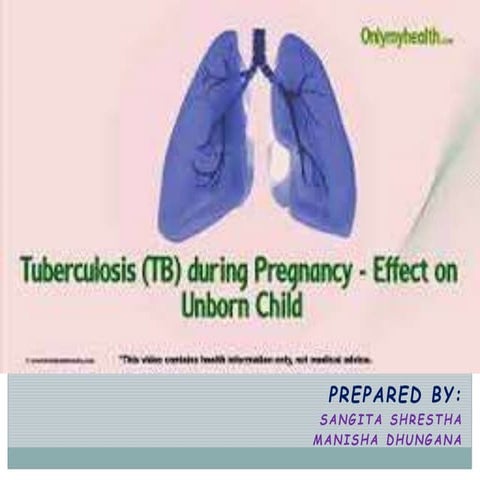 Tuberculosis during pregnancy | PPTX