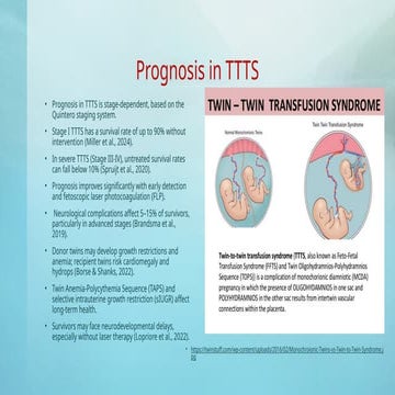 Prognosis in a twin transfusion syndrome. | PPTX