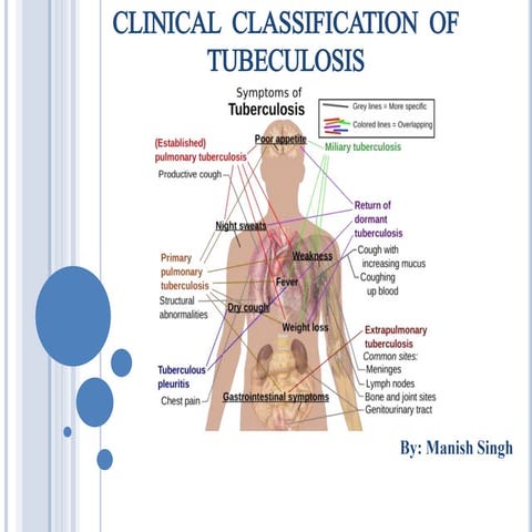CLINICAL CLASSIFICATION OF TUBECULOSIS | PPTX
