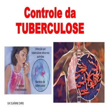 TUBERCULOSE.pptx