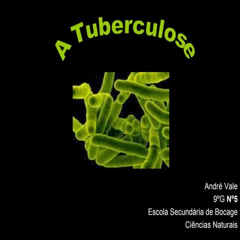 Tuberculose | PPT