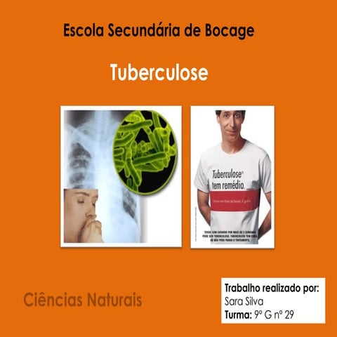 Tuberculose | PPT