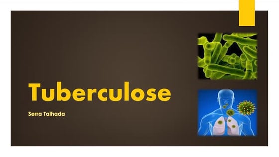 Aula tuberculose | PPT