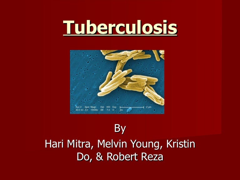 Tuberculosis presentation