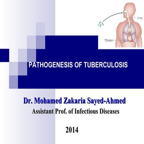 Pathogenesis of tuberculosis | PPT