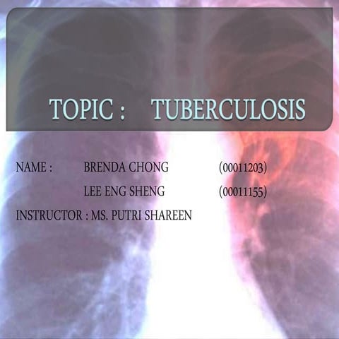 Tuberculosis | PPT