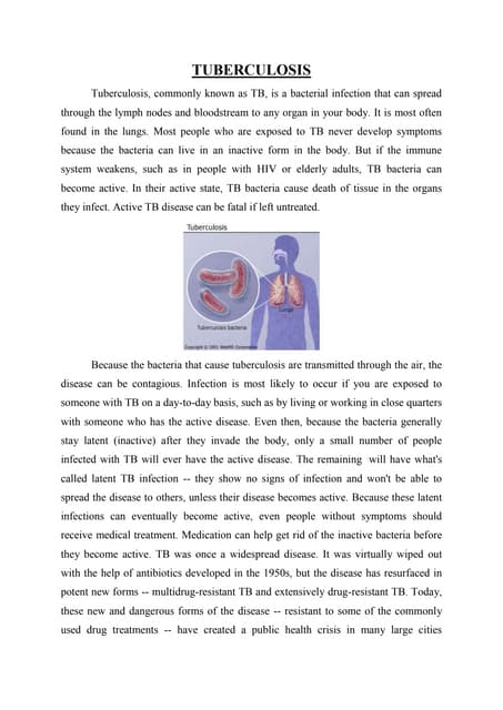 Tuberculosis presentation | PPT