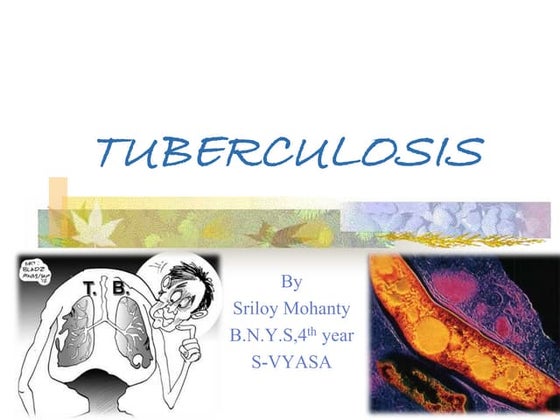 Tuberculosis | PPT