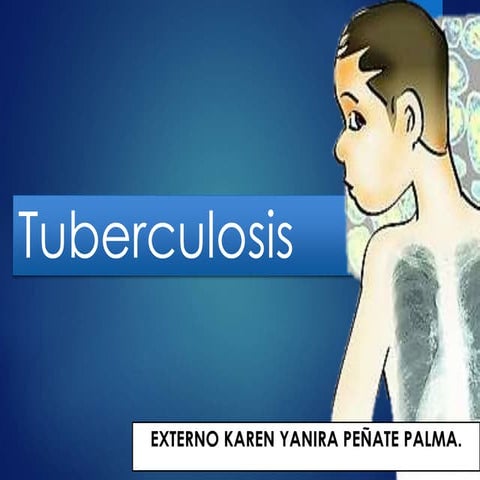 Tuberculosis Guías SIVIGILA INS Ministerio de Salud | PPTX