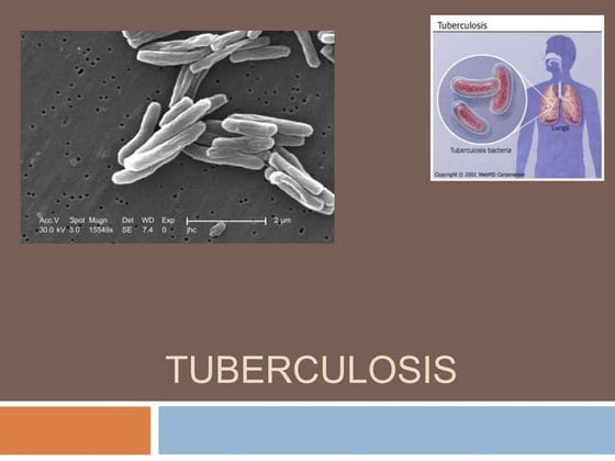 POWERPOINT TB PARU | PPTX