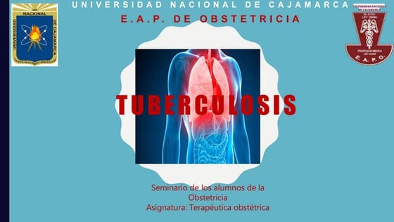 2. Aspectos generales de la TB.pptx