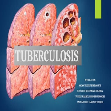 TUBERCULOSIS, definición, causas,sintomas2.pptx