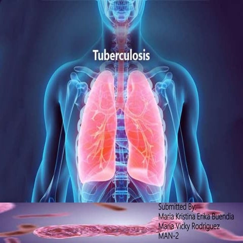 Tuberculosis.man