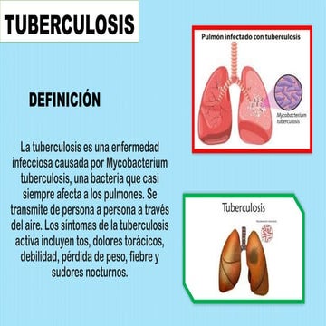 TUBERCULOSIS.pptx................................................. | PPTX