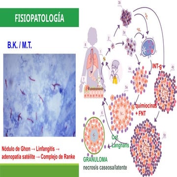 diapositiva para exposicion Tuberculosis.pptx