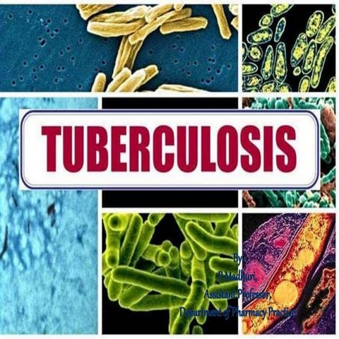 Tuberculosis | PPTX
