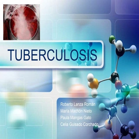 Mural Tuberculosis | PPT