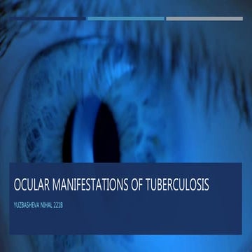 Ocular Manifestations of Tuberculosis | PPT