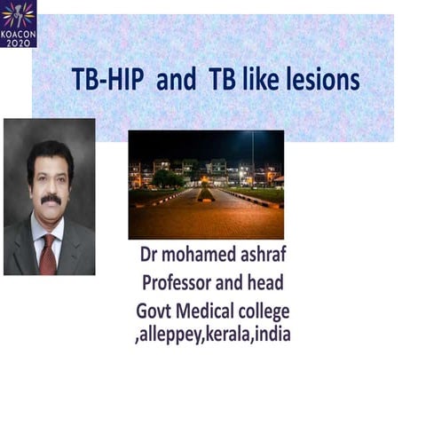 Tuberculosis hip and TB like lesions dr mohamed ashraf -HOD-govt TD ...