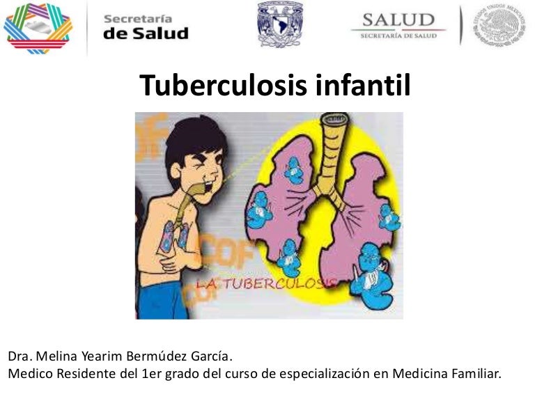 Tuberculosis infantil