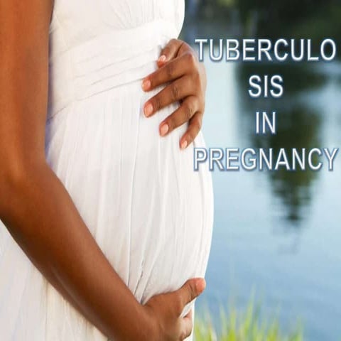 Tuberculosis in pregnancy | PPTX