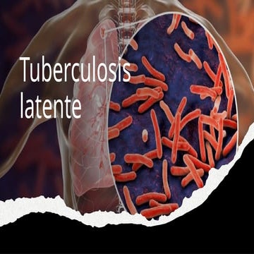 Definicion y tratamiento de la Tuberculosis latente_TBL.pptx