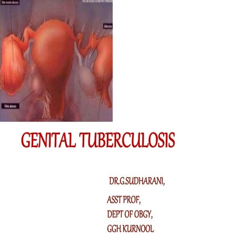 Tuberculosis of genital tract presentation | PPTX