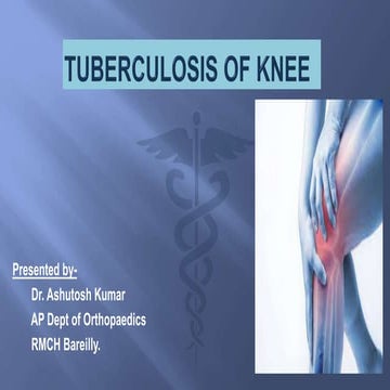 Tuberculosis of knee by dr ashutosh | PPTX