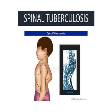 Skeletal tuberculosis