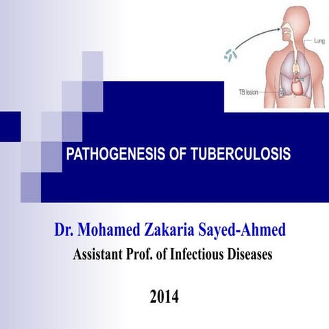 Pathology of Tuberculosis, pathogenesis of Tuberculosis | PPTX