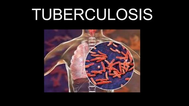 Pathophysiology of tuberculosis | PPTX