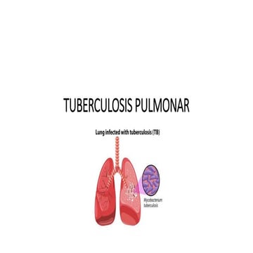 Tuberculosis pulmonar | PPTX