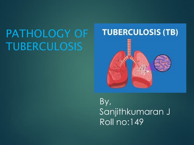 Pathophysiology of tuberculosis | PPTX