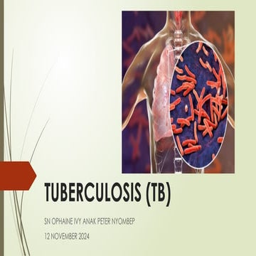 TUBERCULOSIS (TB) general topic in Malaysia | PPTX