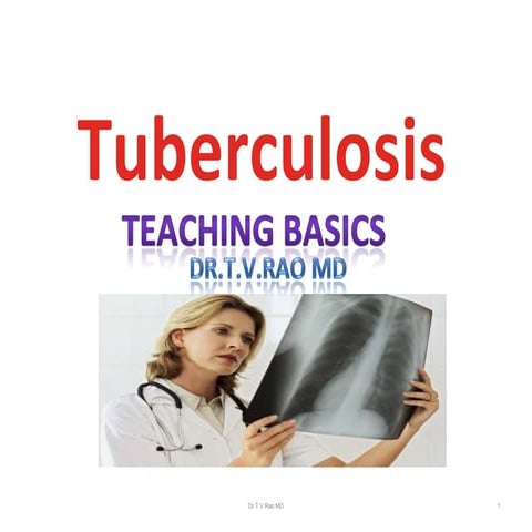 Tuberculosis Teaching Basics | PPT