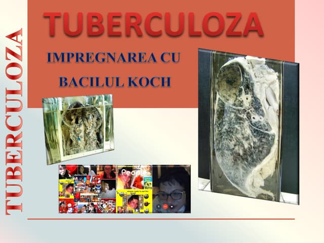 Lectie 27 igiena_sistemului_respirator.. | PPT