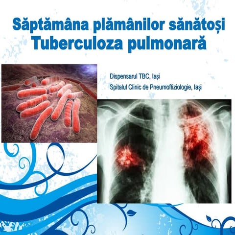 Tuberculoza-prezentare-1 zilele TB 2024.ppt