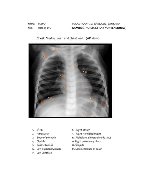 Tugas Anatomi Radiologi 3 | PDF