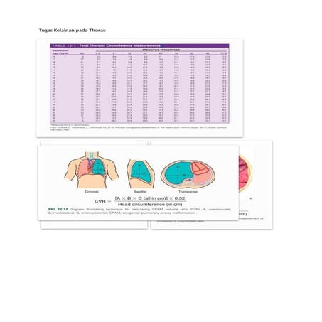 USG pada Tugas Kelainan pada Thorax 2.docx