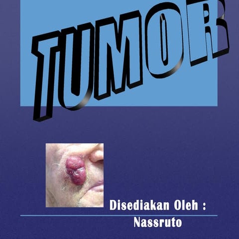 TUMOR | PPT