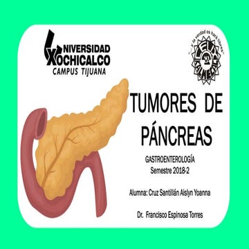 Tumores de pancreas | PDF