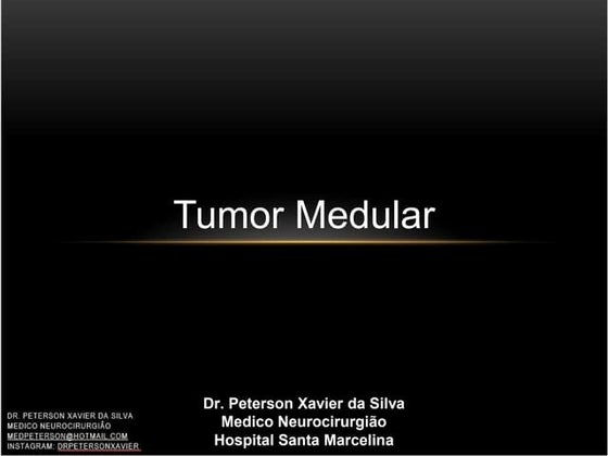 Lipoma Medular | PPT