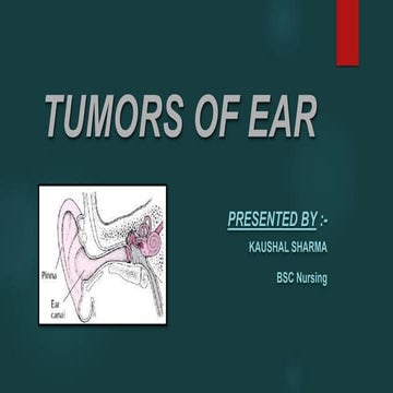 TUMORS OF EAR | PPTX