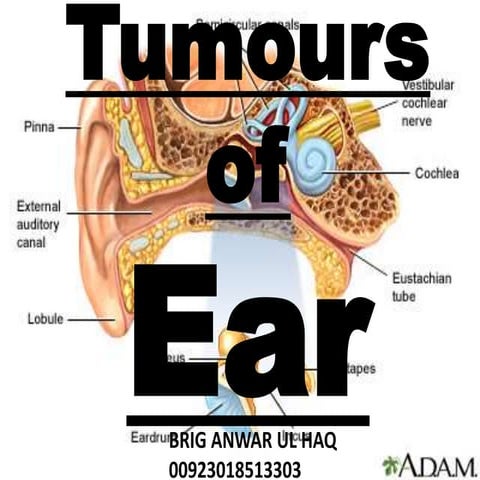 Tumours of Ear | PPT