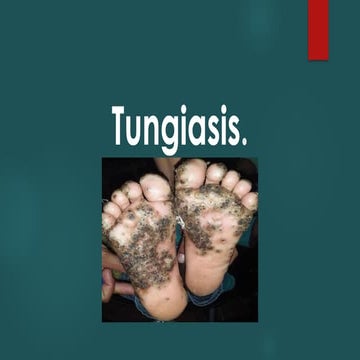 una vista general sobre la tungiasis.pptx