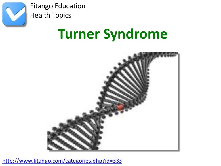 Turner Syndrome Diagram