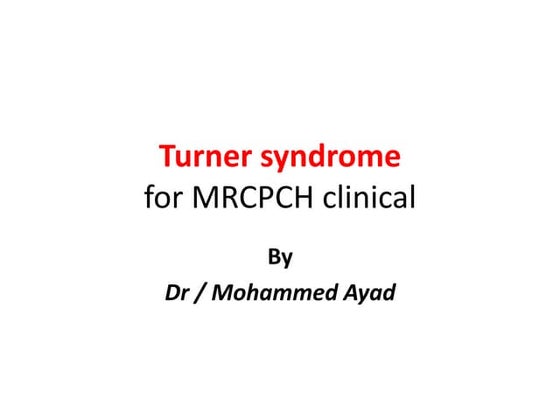 Turner's syndrome | PPT