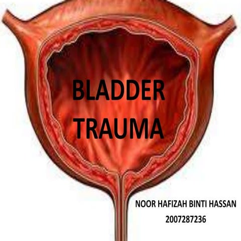 Tutorial bladder trauma | PPTX