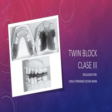 Class ii malocclusion | PPTX